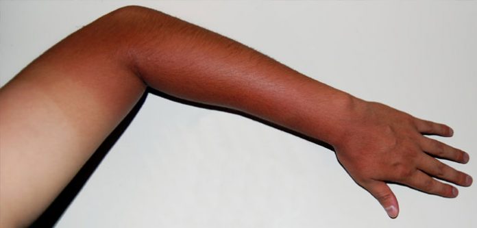 Top 10 Essential Sun tanning Tips